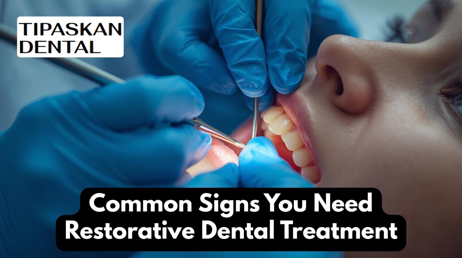 Common Signs You Need Restorative Dental Treatment